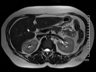 MRI Practice Quiz